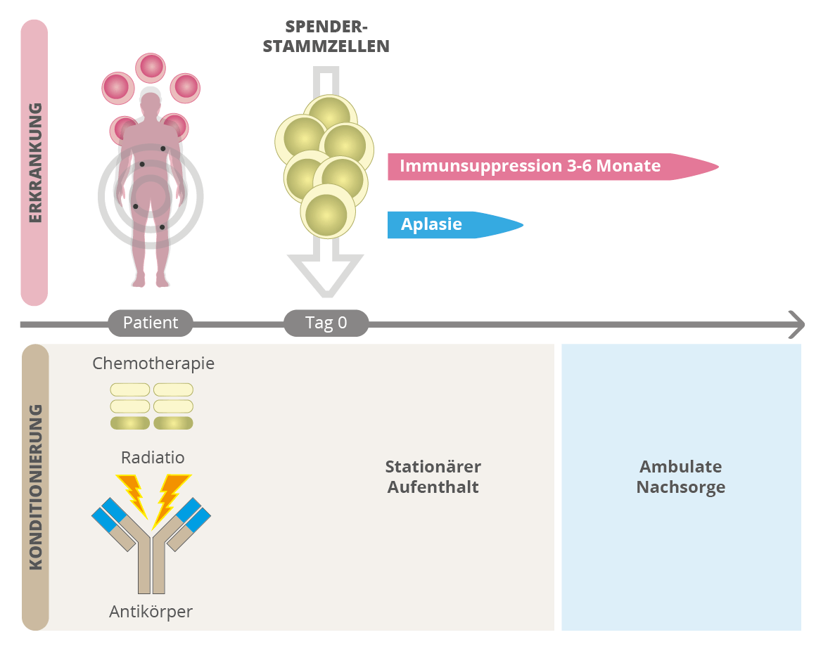 Knochenmarktransplantation – Hämatologie der Uniklinik